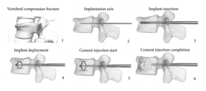 Part 4: New 2022 Technology Add-On Payments (NTAP)