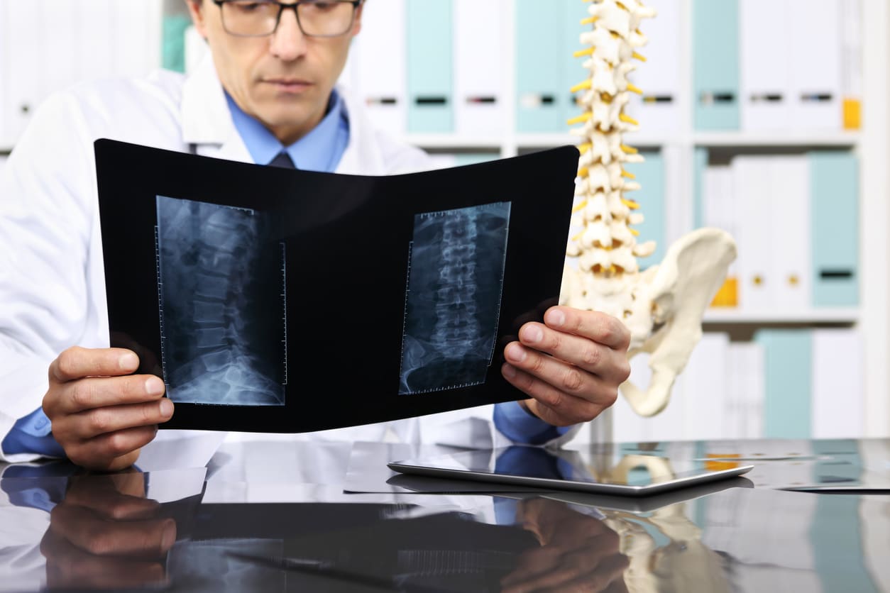 Bone Graft Icd 10